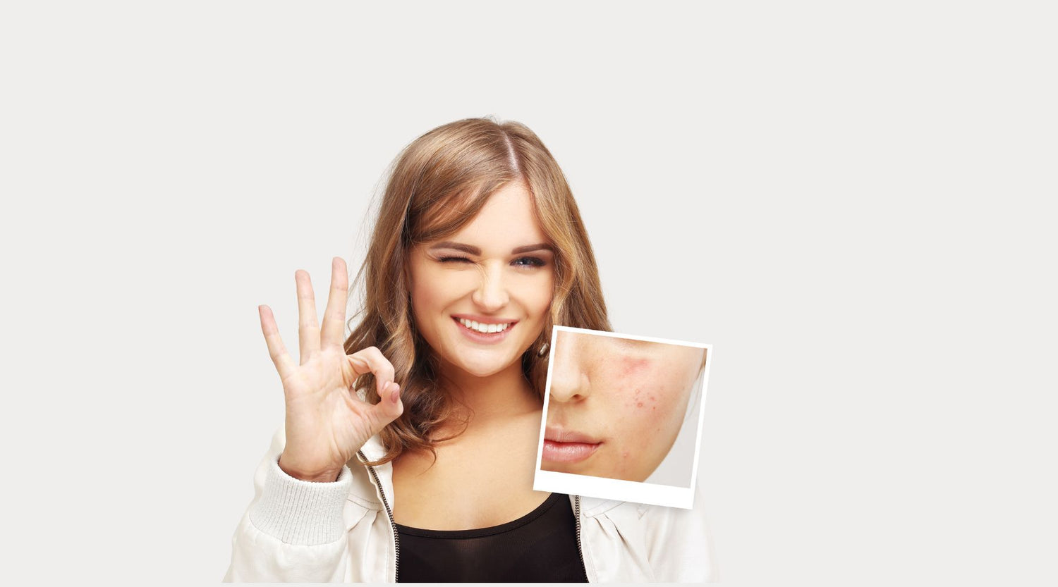 Unveiling Clearer Skin: 7 Water-Based Peeling Techniques to Combat Acn ...